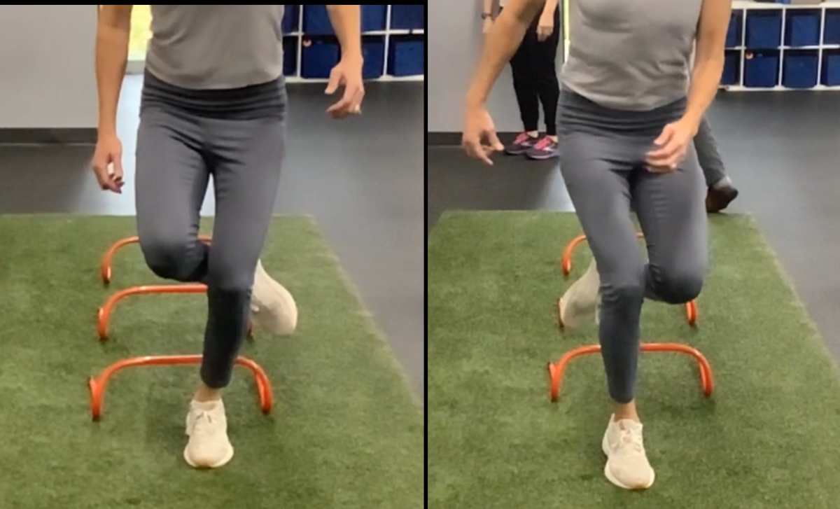 Landing Mechanics After ACL Repair